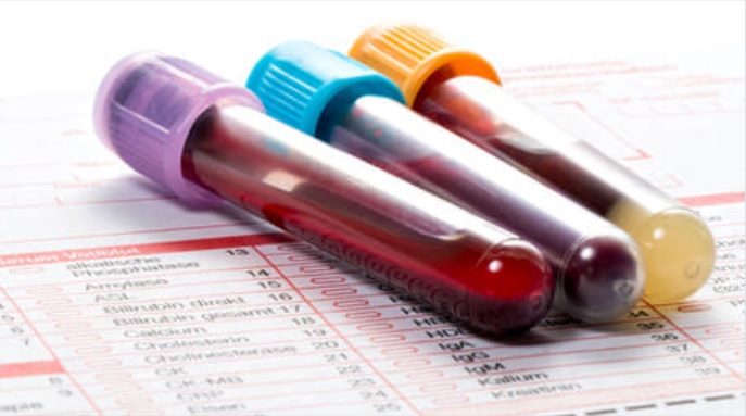 TAHAP HEMOGLOBIN YANG TINGGI – Dr Zubaidi Hj Ahmad Menulis